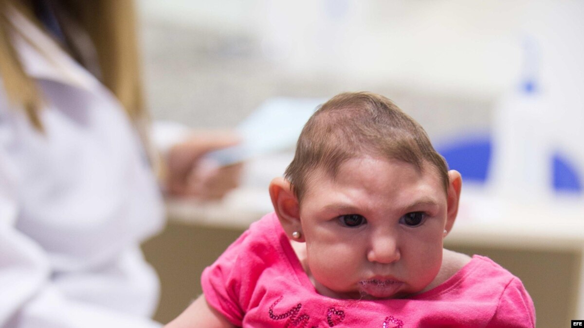 OMS confirma conexión entre Zika y microcefalia